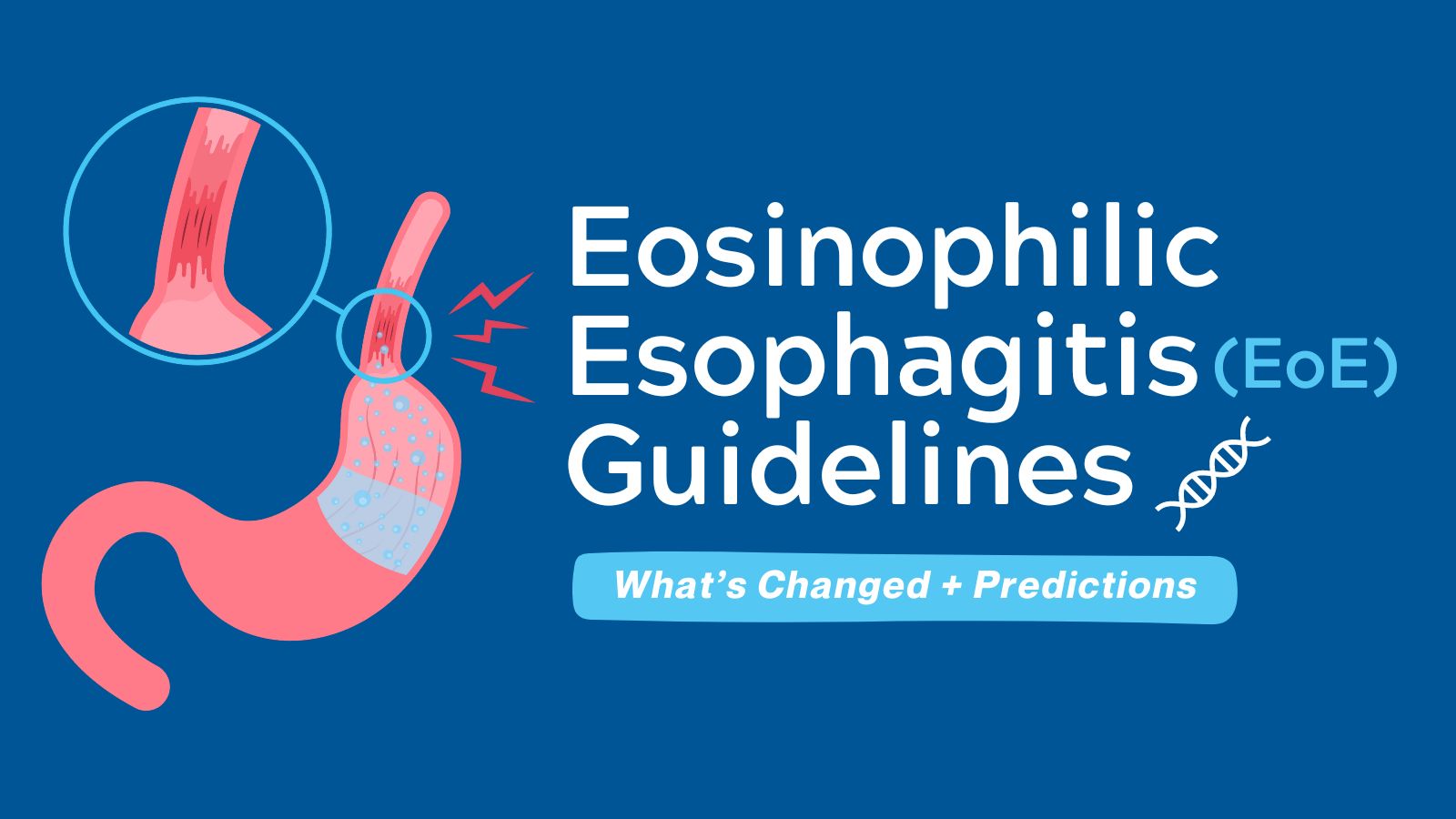 Eosinophilic Esophagitis Guidelines - What’s Changed Since+ Guidelines ...