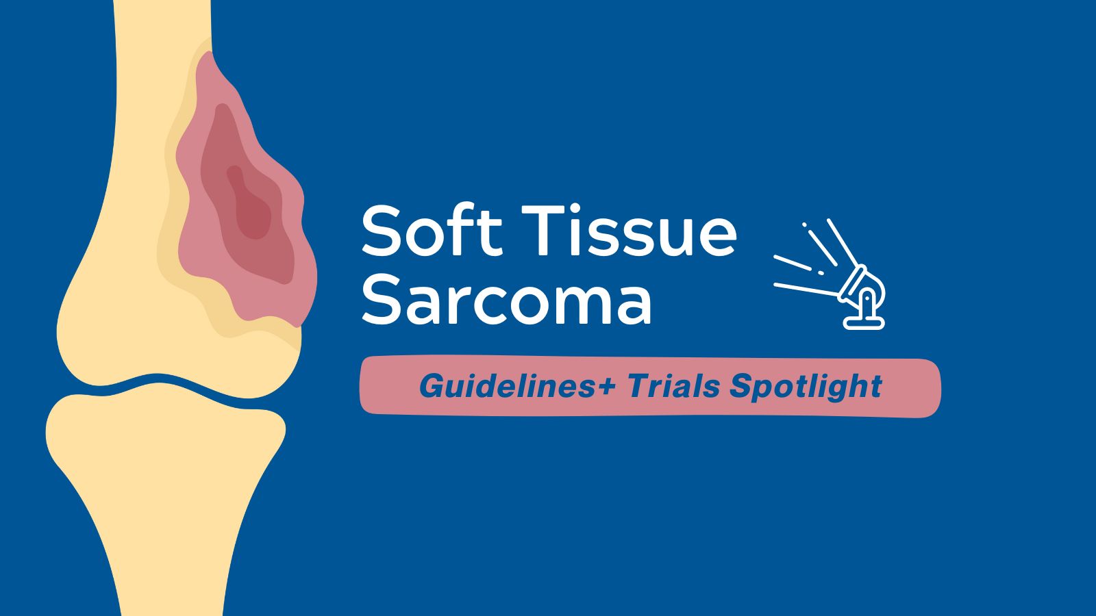 Soft Tissue Sarcoma - Guidelines+ Trials Rundown - Guideline Central