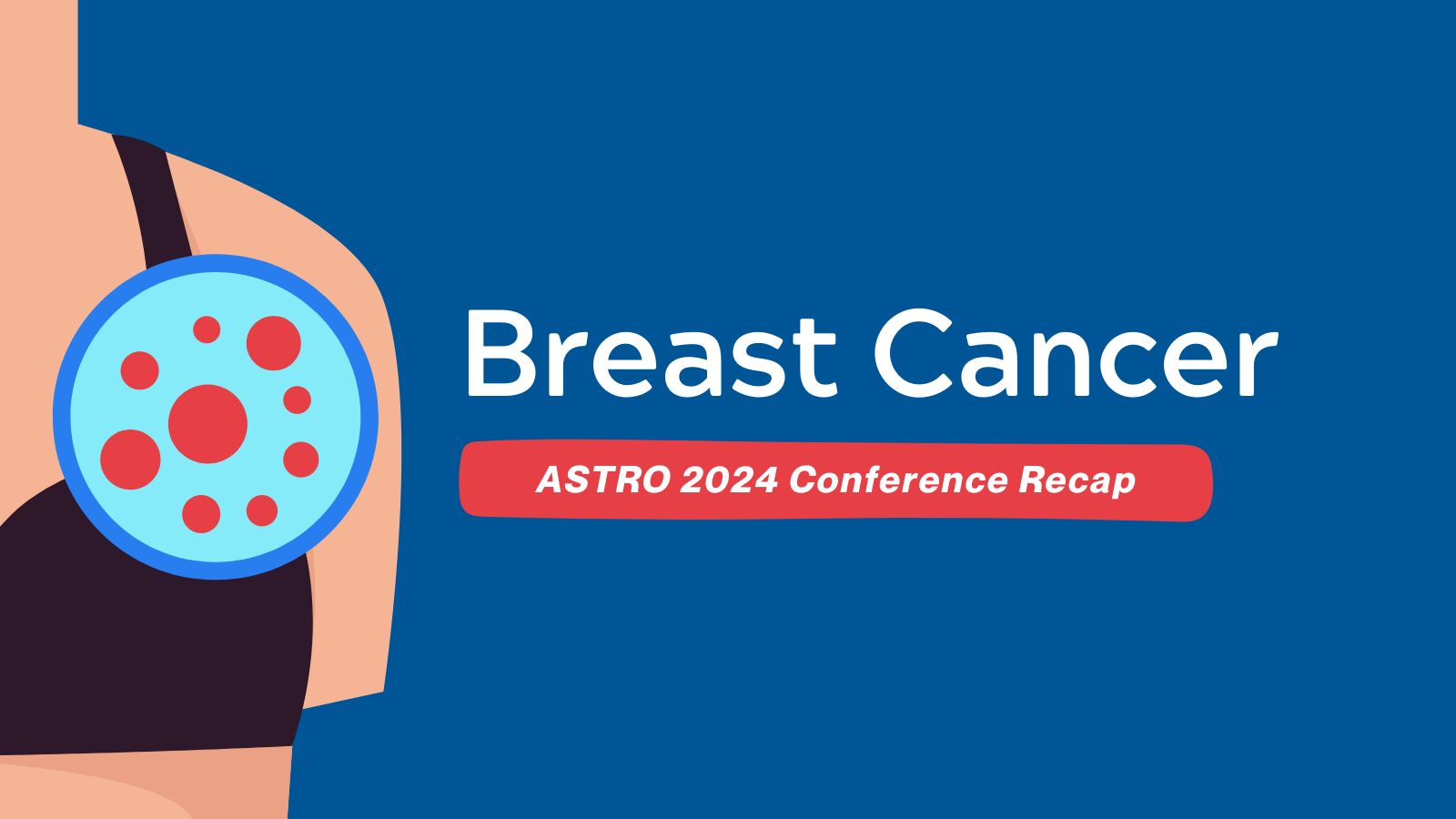 Breast Cancer Insights from ASTRO 2024 - Conference Recap - Guideline Central