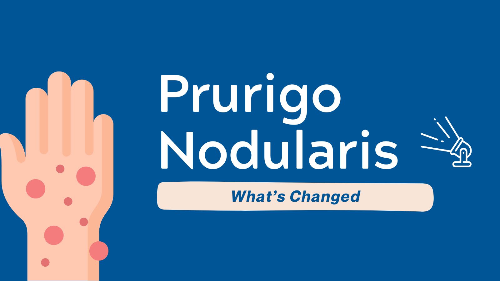 Prurigo Nodularis - What's Changed - Guideline Central