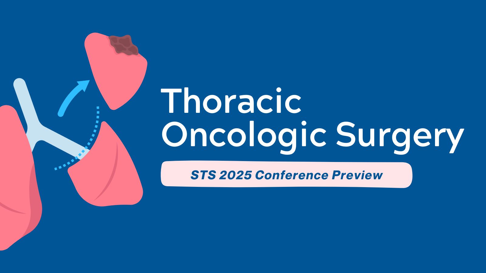 The 61st STS Annual Meeting - Conference Preview on Thoracic Oncologic ...