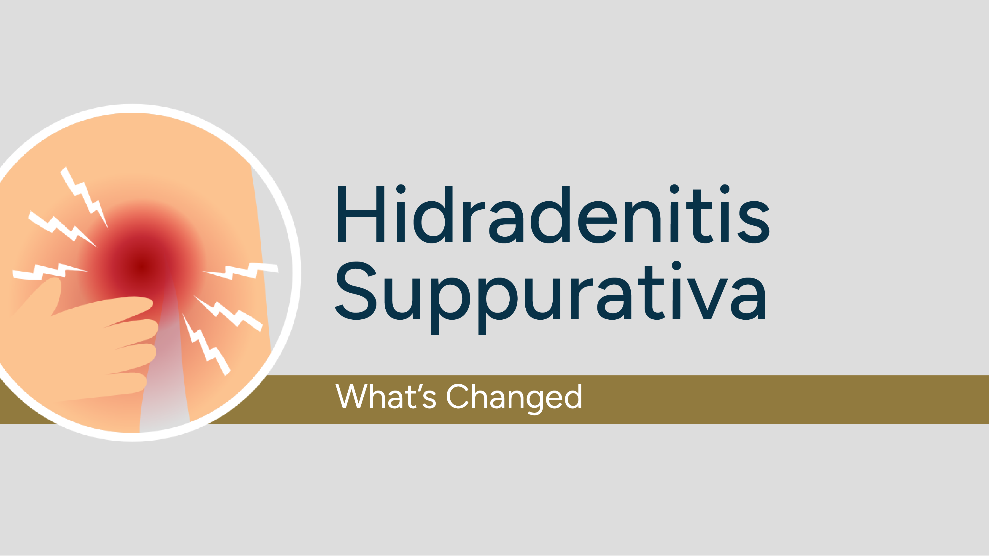 Hidradenitis Suppurativa - What's Changed - Guideline Central