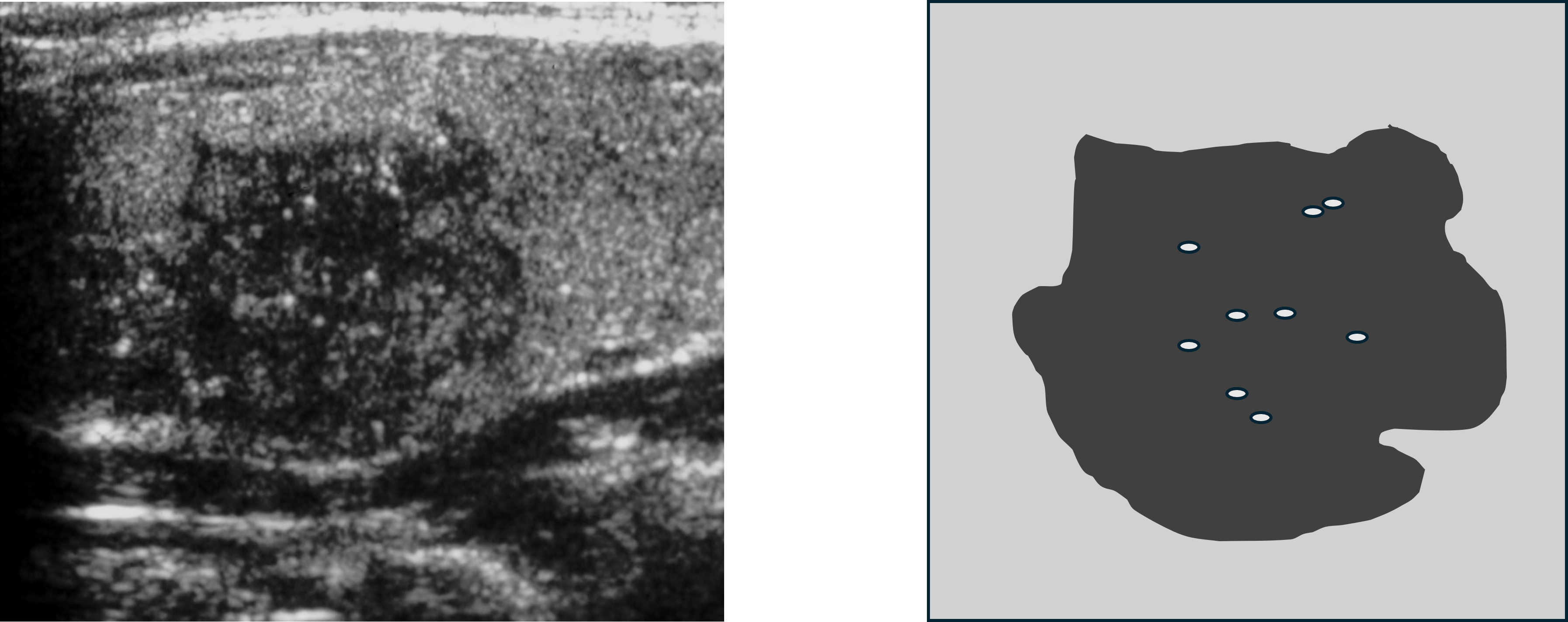 ATA 2026 Sonographic Classification and Assessment of Thyroid Nodules ...